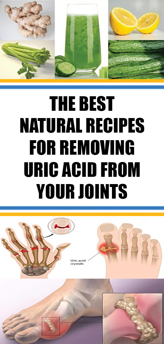 The Best Natural Recipe For Removing Uric Acid From Your Joints - Id ...