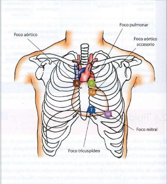 Neo médico : Focos de auscultación cardíaca.