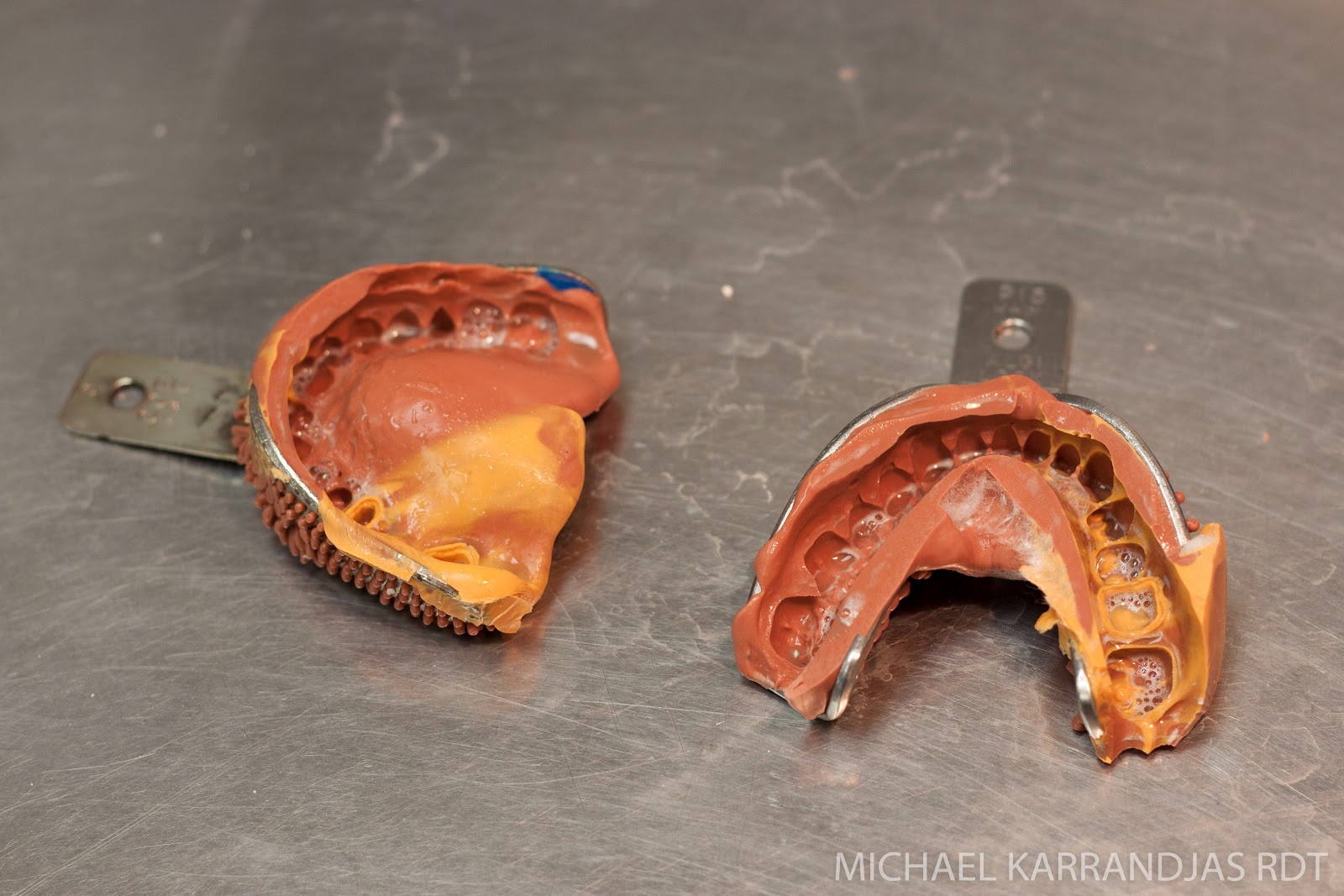 Dental Lab Model Pouring | Making Noise And Drinking Beer