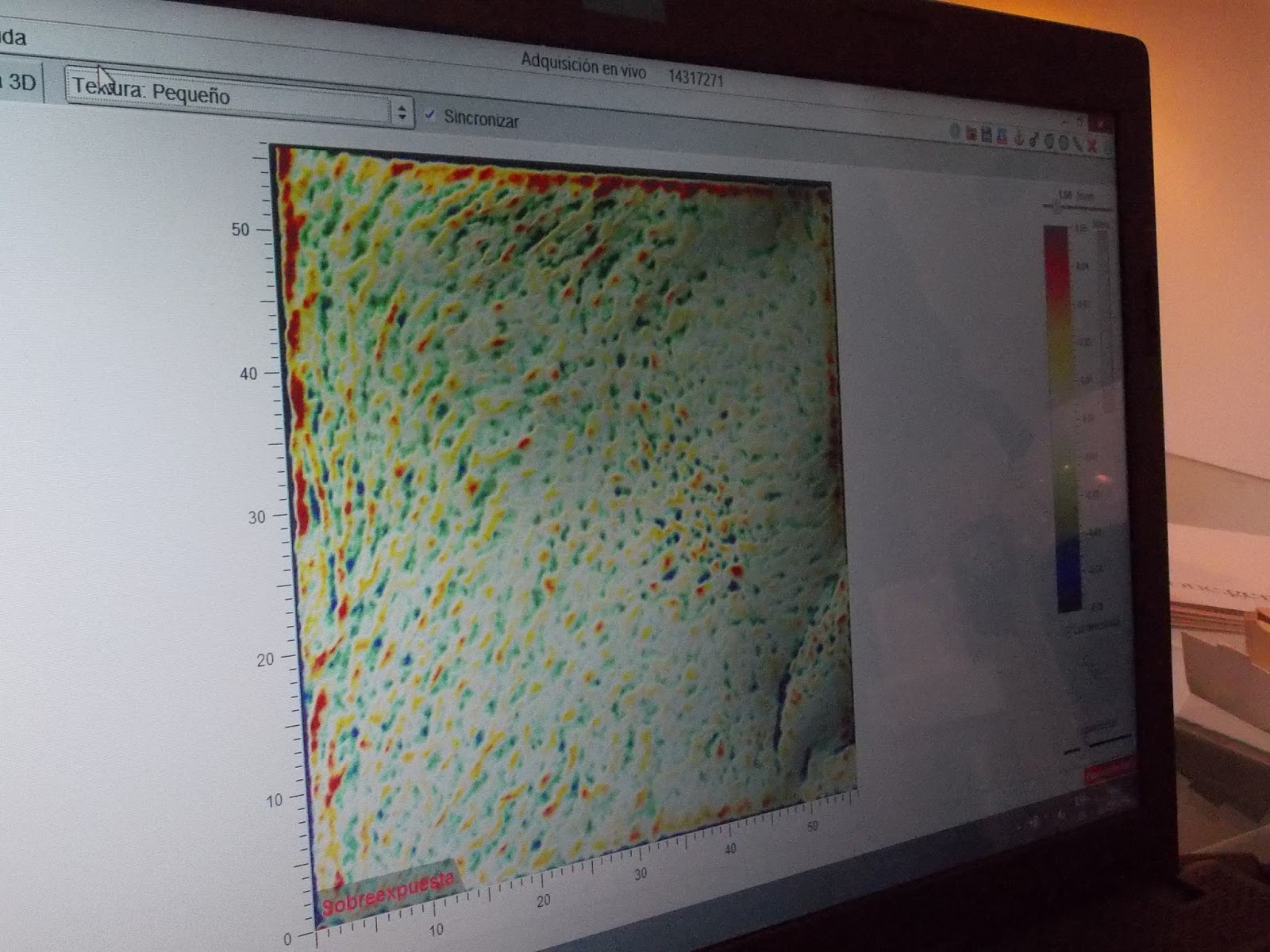 ANTERA 3D, el escáner más completo para analizar la piel
