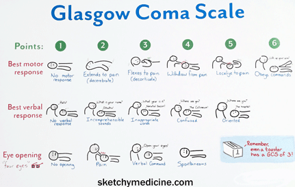 Cara Mengetahui Tingkat Kesadaran Pasien Dengan GLASGOW COMA SCALA (GCS ...