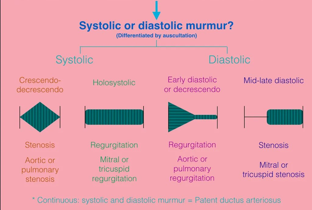 Approach to heart murmurs - Schema