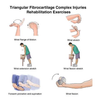TFCC (Triangular Fibrocartilage complex) tear: Triangular Fibrocartilage complex (TFCC)