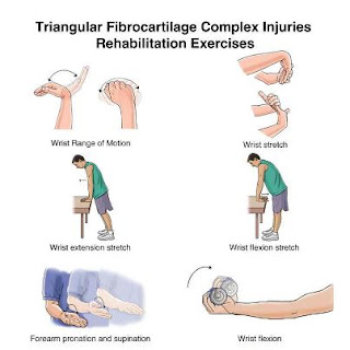 TFCC (Triangular Fibrocartilage complex) tear: Triangular ...