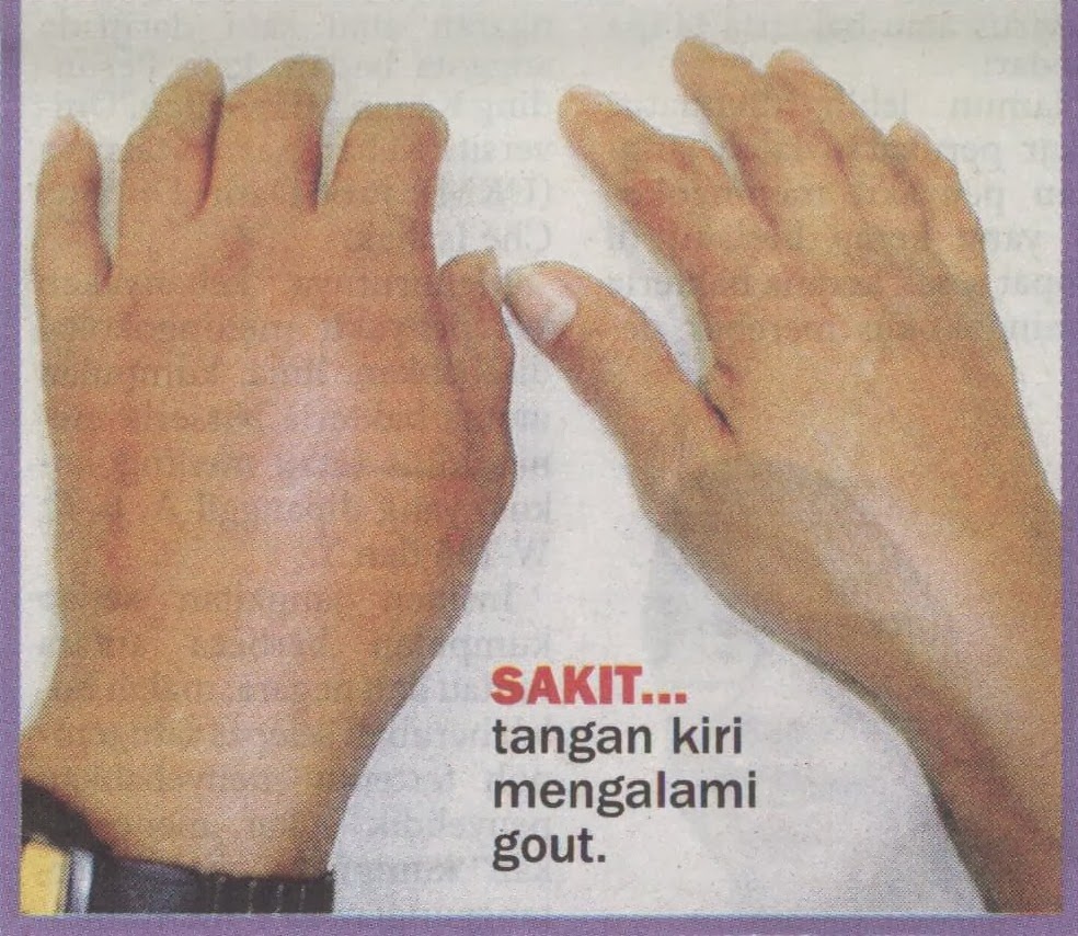 :: DiRa ::: Suplemen Gout Dengan Shaklee
