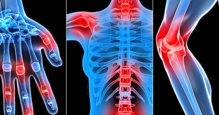 Apa yang Disebut Sendi Tulang, dan Apa saja Jenis-jenisnya? | Belajar ...