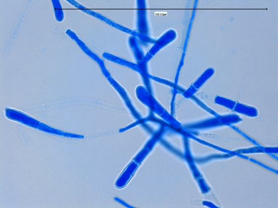 Fun With Microbiology (What's Buggin' You?): Epidermophyton floccosum