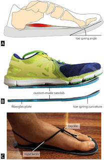 Running Solutions: Toe Spring And Plantar Fasciitis