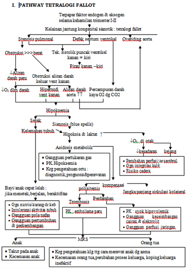 Dunia Keperawatan: Makalah Tetralogi of Fallot (TOF)
