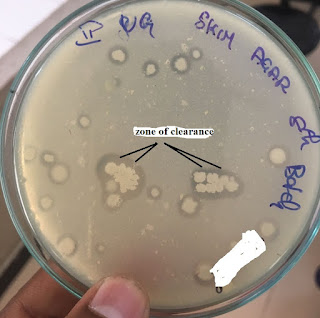 SENTHIL PRABHU SIVASAMY: Casein Hydrolysis Test