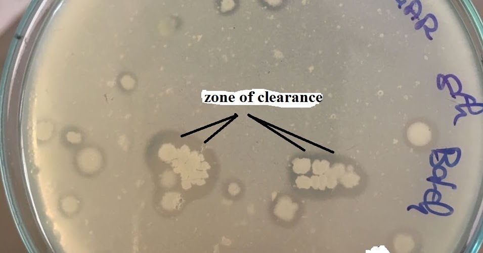 SENTHIL PRABHU SIVASAMY: Casein Hydrolysis Test