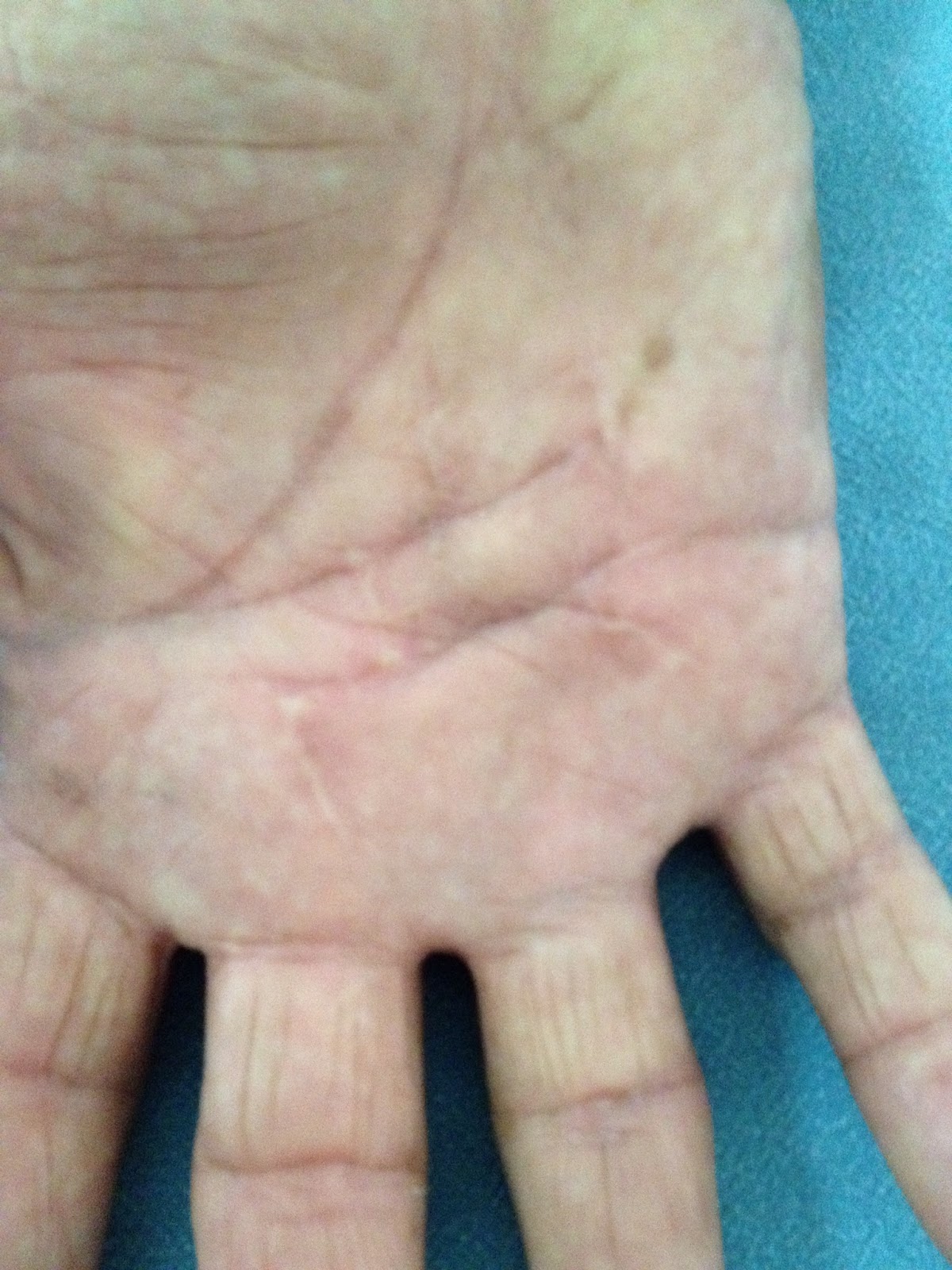 OSSA CARPALIA ©: 2012