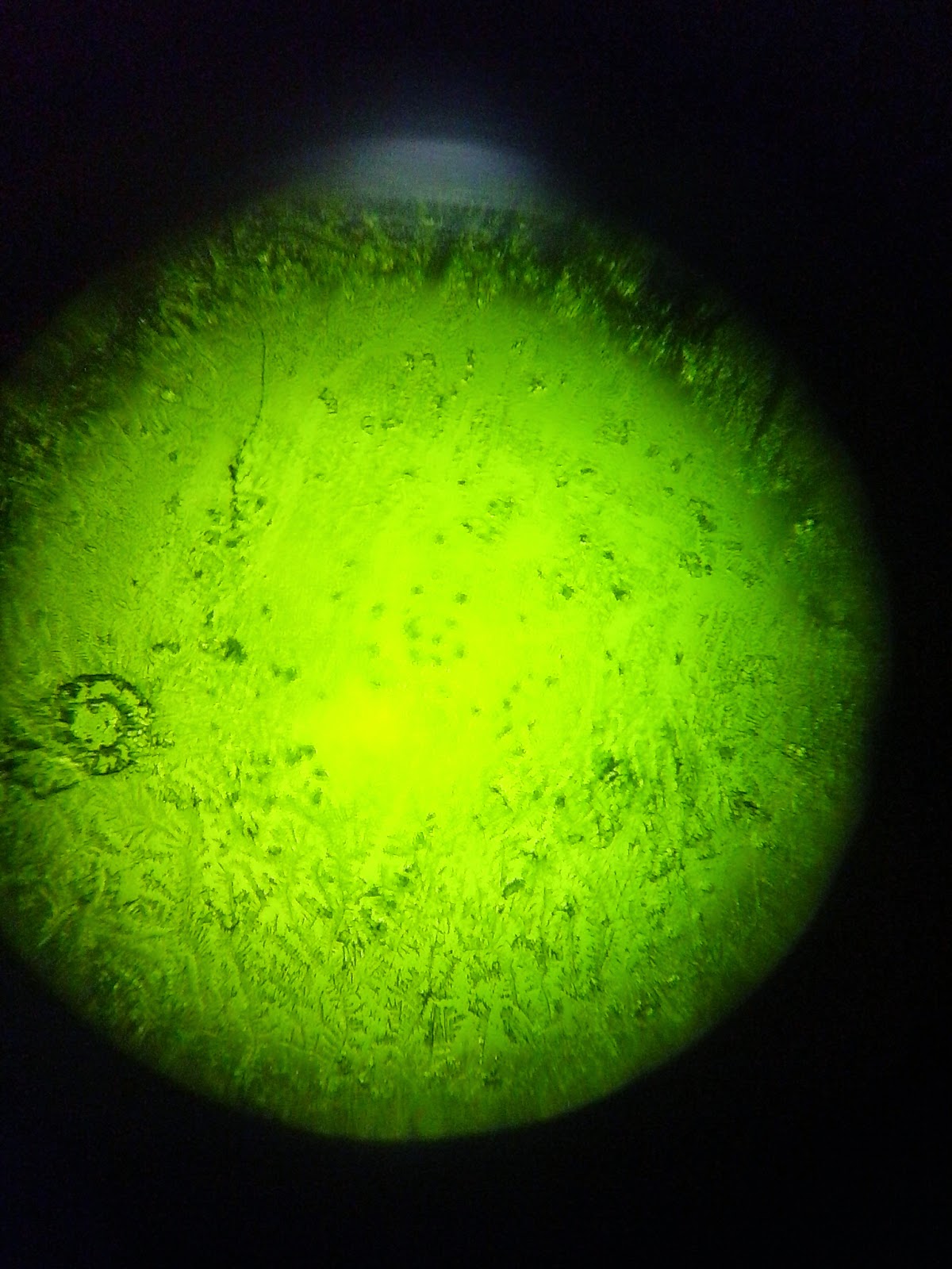 TTC with Saliva Microscope: Day by day ferning - Maybe Baby Saliva ...