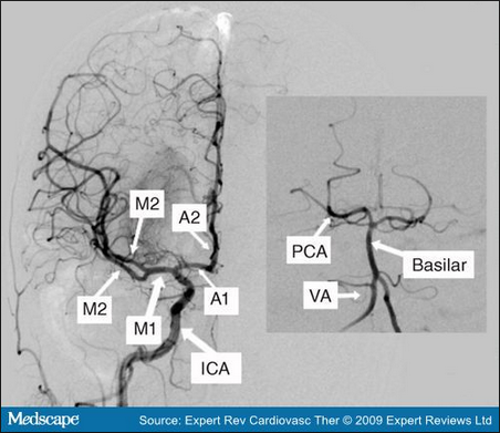 Ten Things That I Learned Today
