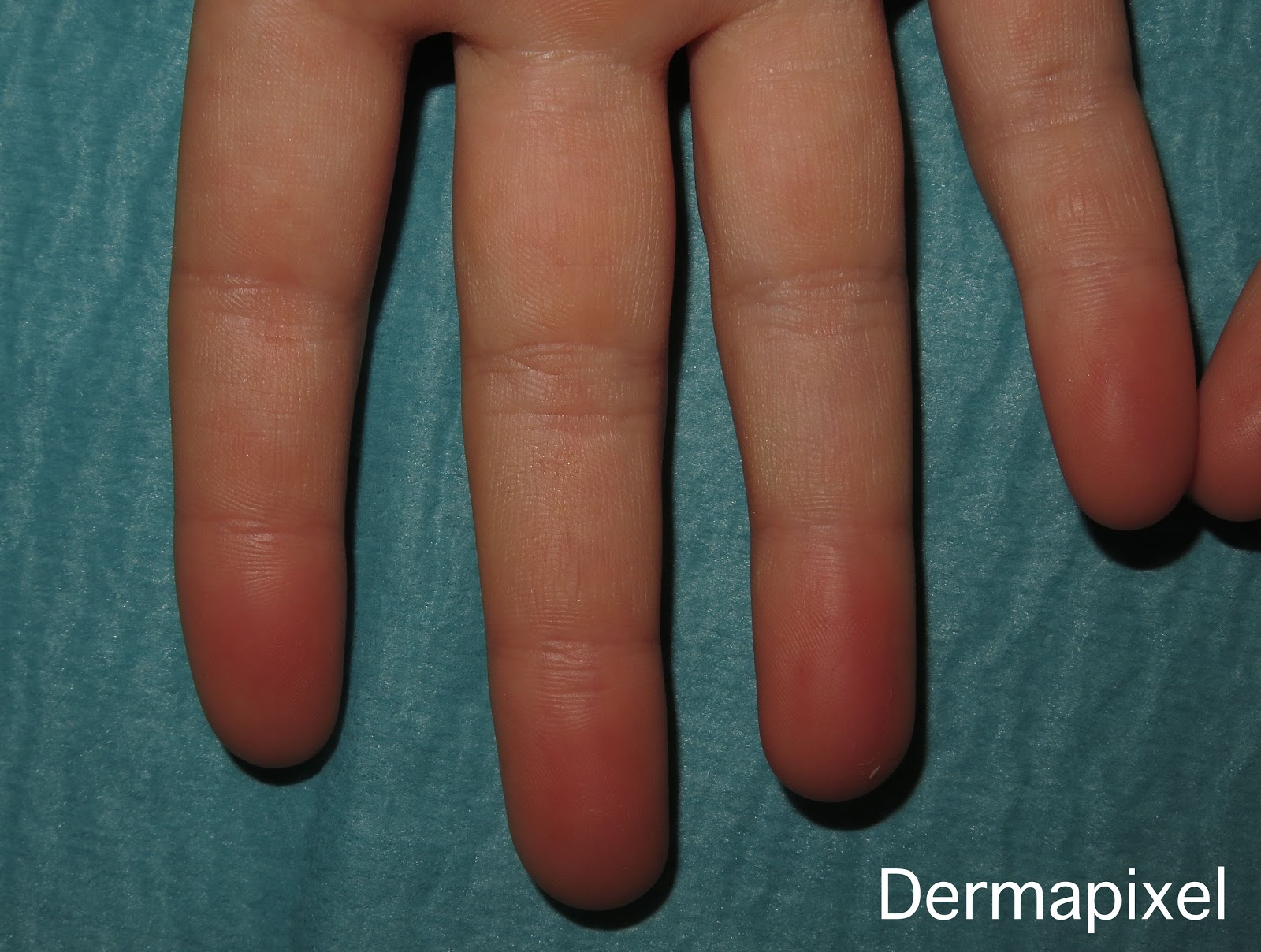 Dermapixel: agosto 2018