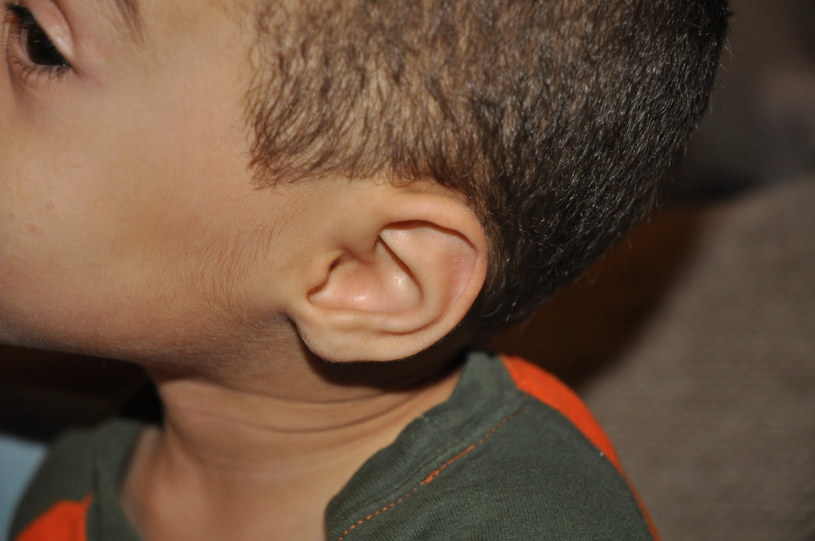 Taking on The World With Our Boy: Bee Sting Update