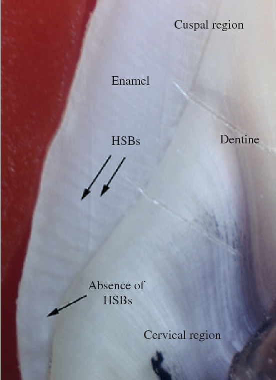 Tooth Enamel- Composition, Properties, Structure and Functions