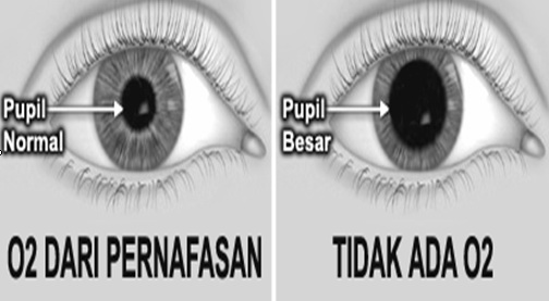 P3K DI DAERAH OPERASI (MATERI PPGD)