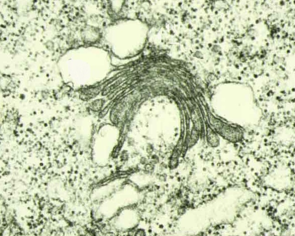 A Biologia da Célula: Complexo Golgiense