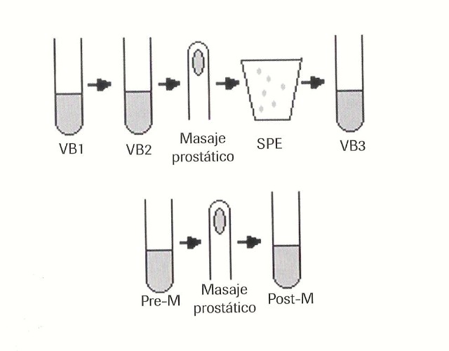 Urología e Historia de la Medicina: Prostatitis. Formas de presentación ...