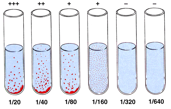 Interpretation Of Widal Test Results interpretation-of-widal-test-results
