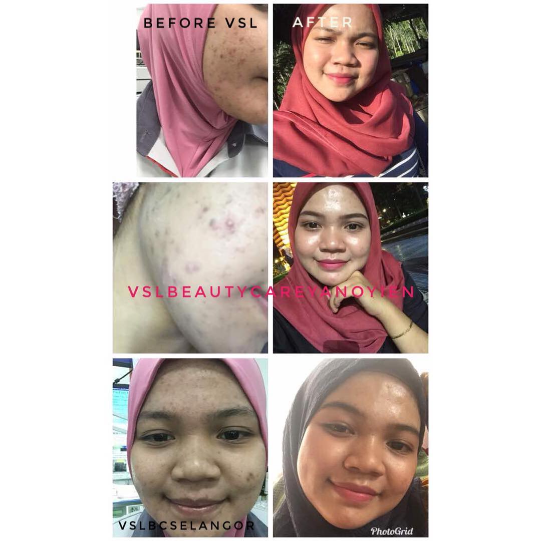 PRODUK PEMUTIH DAN PENGELUPASAN VSL BEAUTY CARE: July 2018