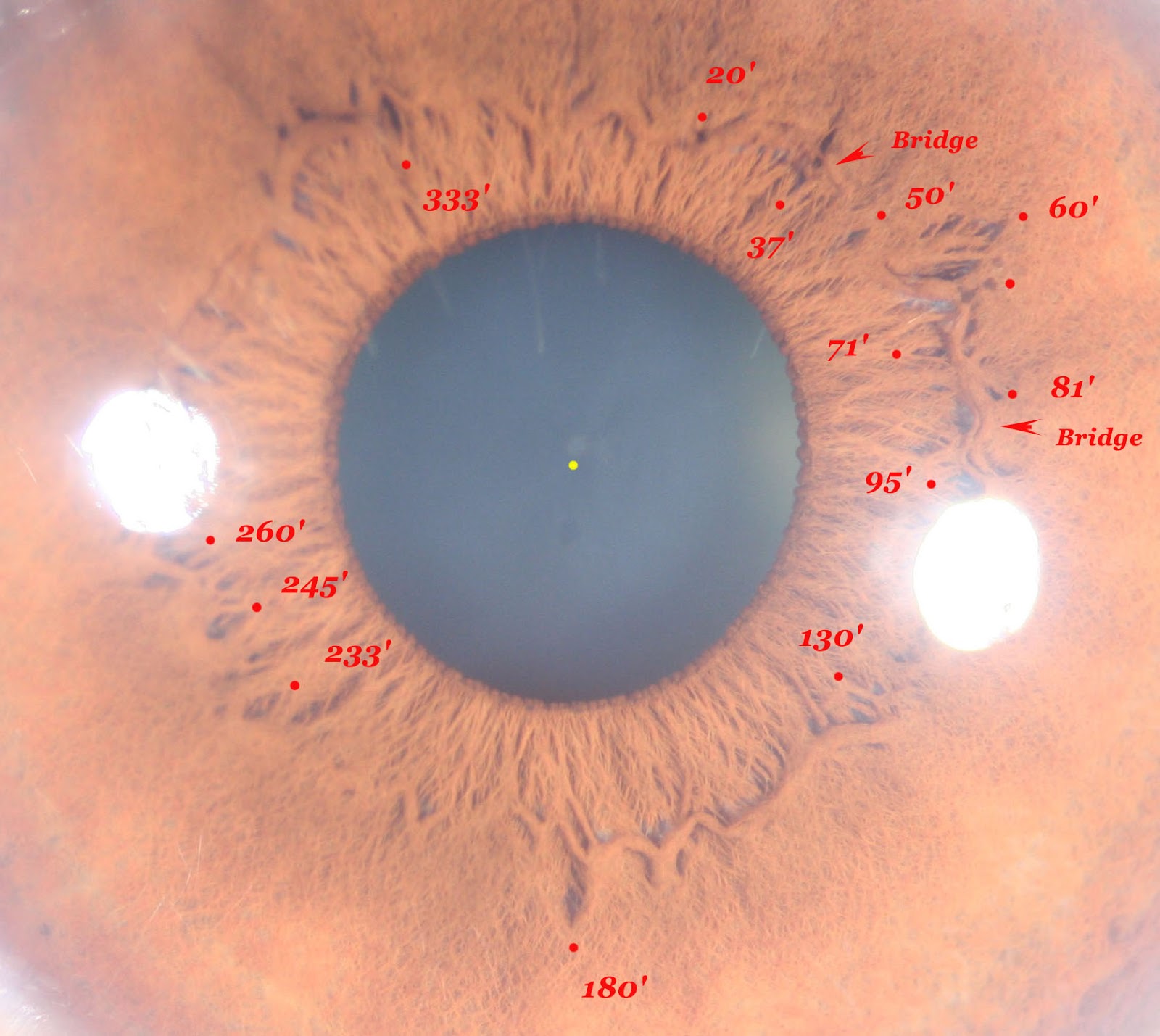 Modern & Multidimensional Iridology: The Internal & External Border of ...