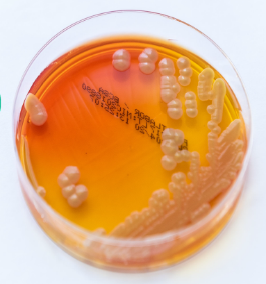 Controle de Qualidade em Indústria: ÁGAR BURKHOLDERIA CEPACIA SELETIVO ...