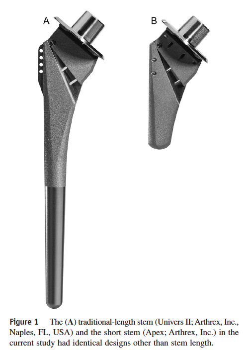 Stress shielding, component positioning with the Arthrex humeral stems ...