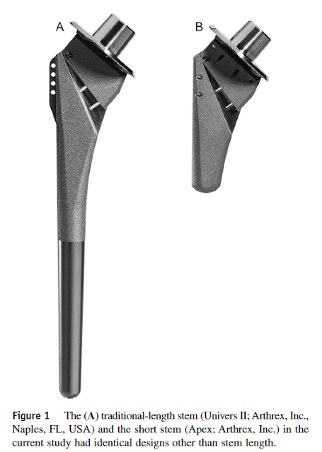 Stress shielding, component positioning with the Arthrex humeral stems ...