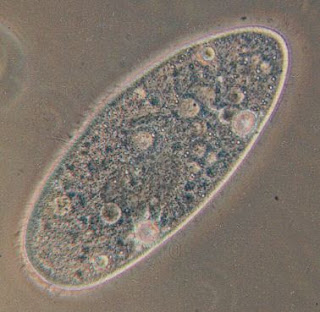 Protozoa berikut ini tergolong.... A. Ciliata B. Sporozoa C. Flagellata ...