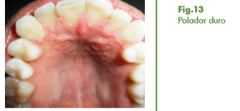 Ilian Nayelli : exploracion de cabeza y cuello