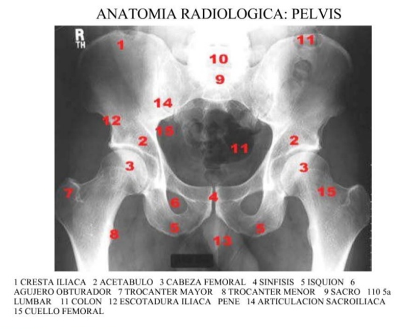 Anatomía Radiológica de Pelvis y Abdomen: Pelvis
