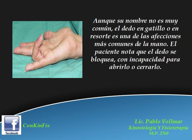 Consultorio Privado de Kinesiología y Fisioterapia: Dedos en Gatillo o ...