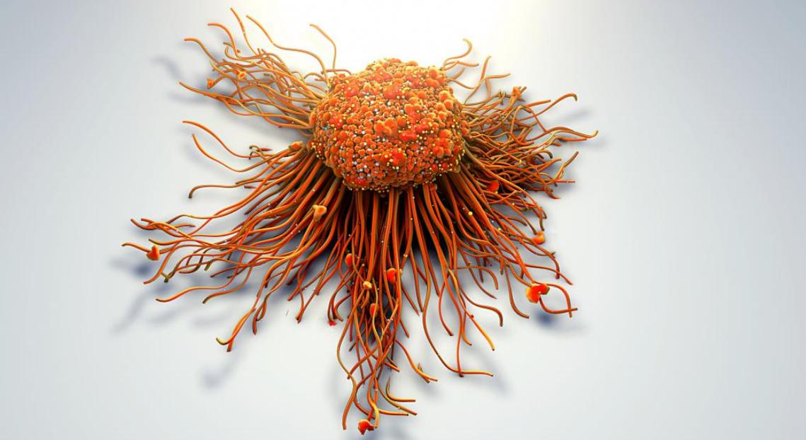 Fungating Tumor Life Expectancy - CancerOz