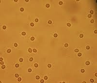 Examen De Orina Microscopico: Examen de Orina Microscopico