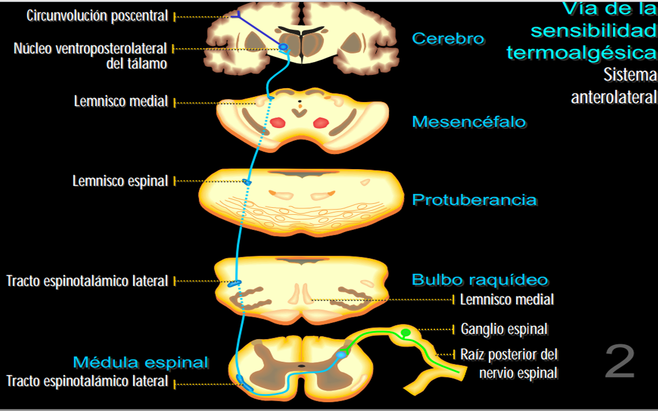 Neuroaprende : Via de la termoalgesia - Espinotalámica lateral