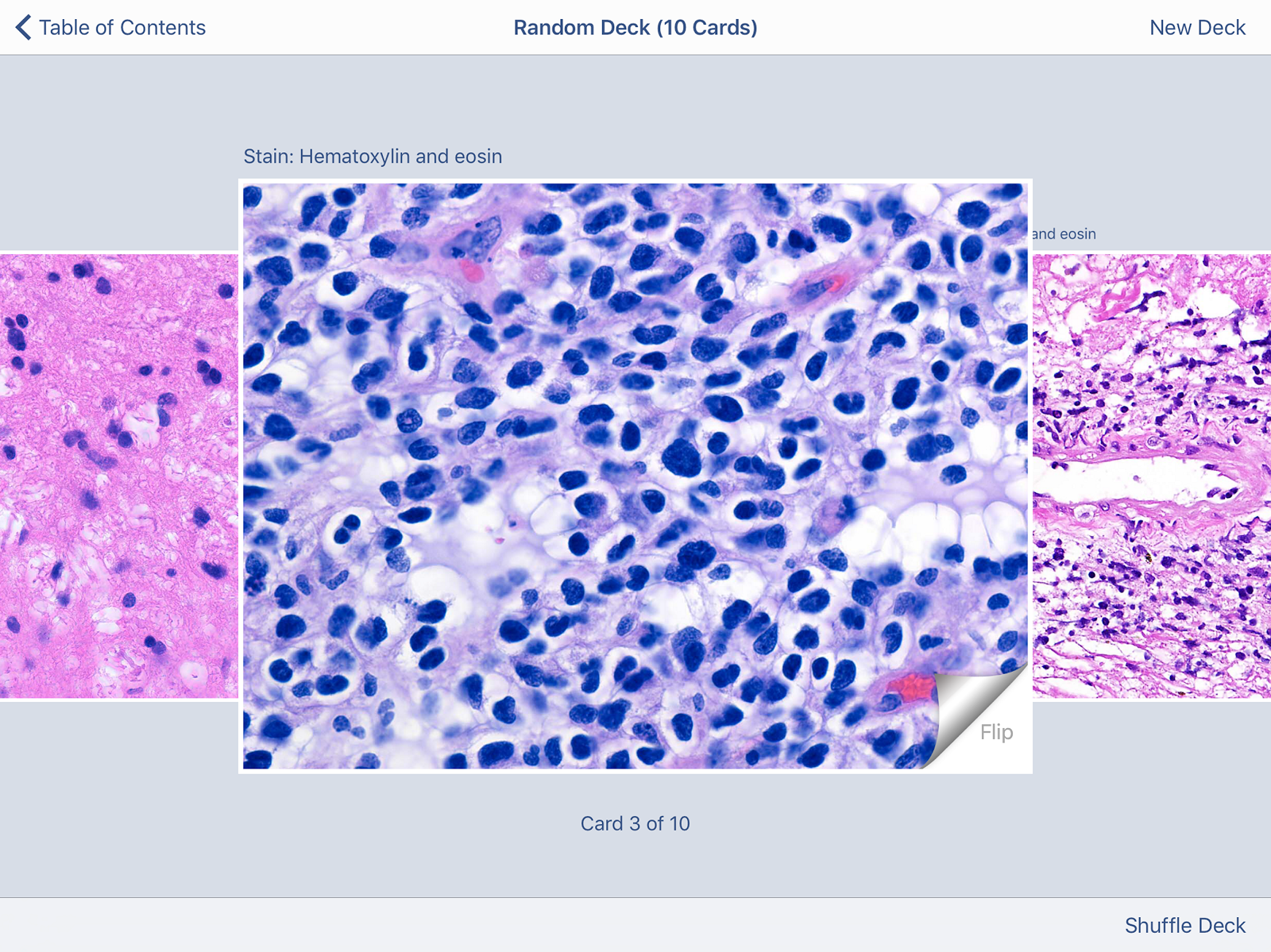 neuropathology blog: Screenshots of the surgical neuropathology volume ...