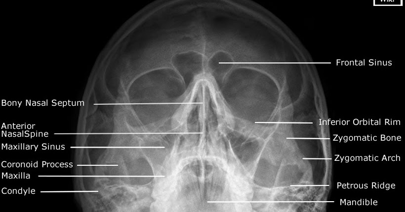 Mundo da Radiologia: Incidências PA Waters