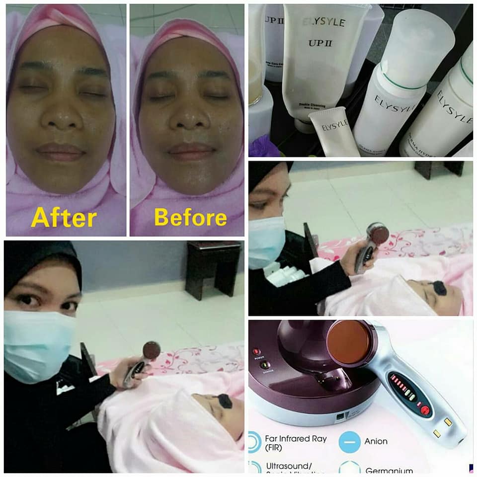 Al Rayyan Beauty and SPA Muslimah: RAWATAN FACIAL MENGGUNAKAN PERANTI AJAIB
