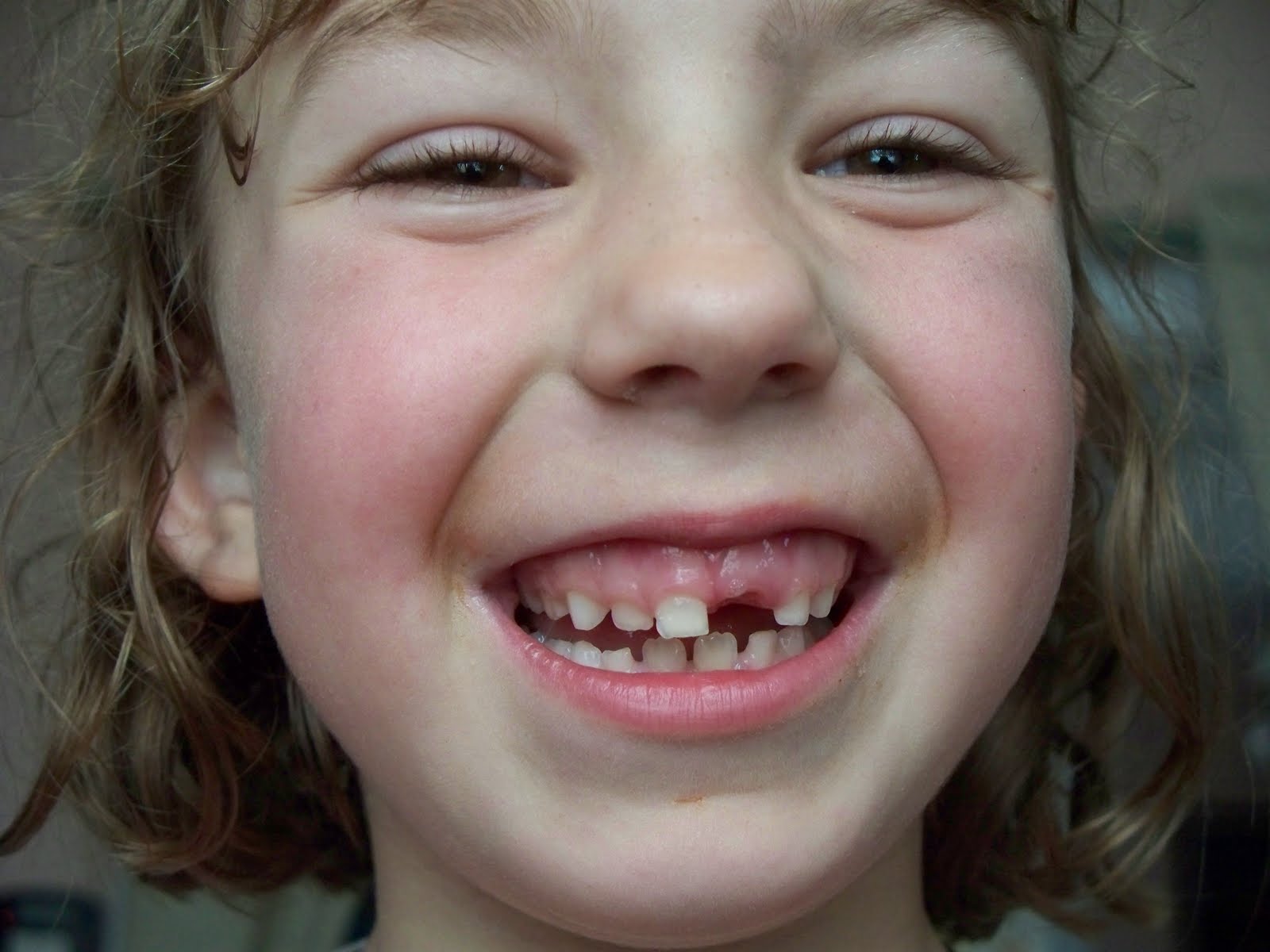 Canadian Scrap Tramp: The lost teeth