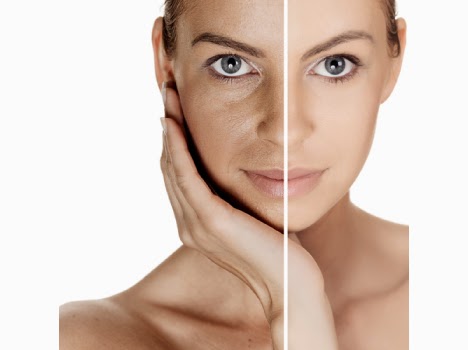 Beauty Spot: 20 Simple Wrinkle Erasers