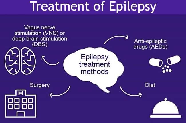 Epilepsy: Symptoms, Causes, and Treatments - How to Prevent Epileptic ...