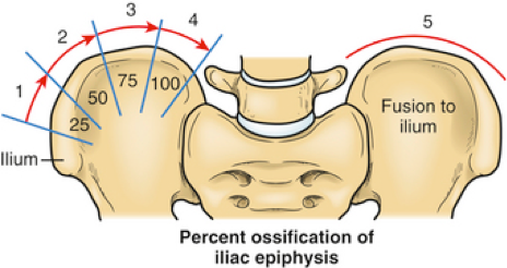 What is Bone Age? Why does it matter for treatment of scoliosis ...