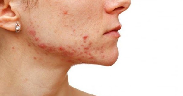 Dermatologist Clinic in Gurgaon: AA Derma Science: Covers every Aspect ...