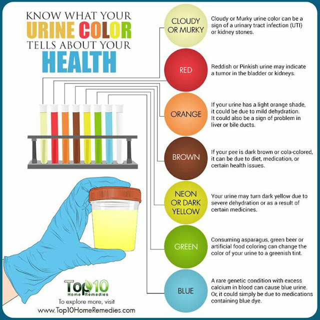 URINE EXAMINATION urine-examination