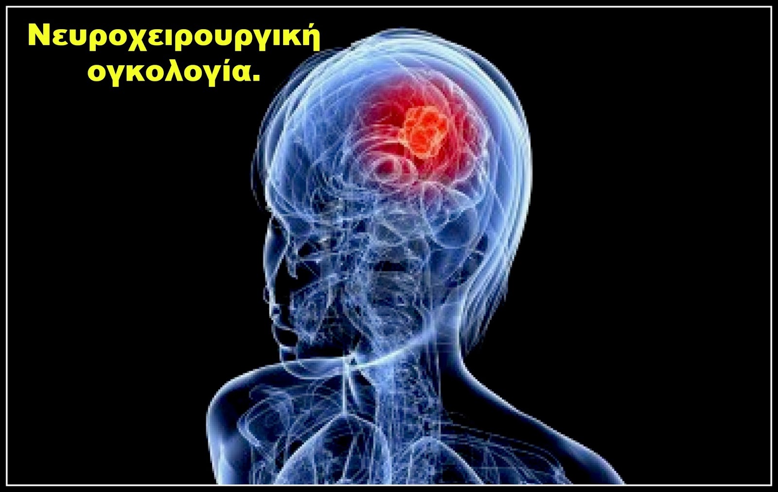 Κωνσταντίνος Χ. Δαβανέλος: Νευροχειρουργική ογκολογία.