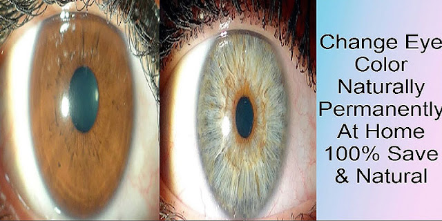 How To Change Your Eyes Color Naturally & Permanently 100% Save - The ...