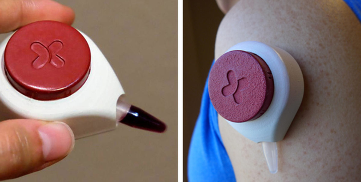 Medical Laboratory and Biomedical Science: New Microfluidic Blood-draw ...