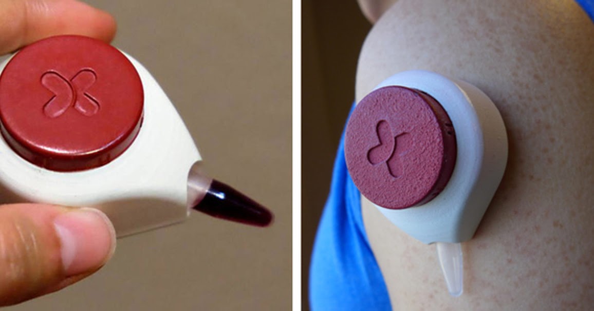 Medical Laboratory and Biomedical Science: New Microfluidic Blood-draw ...